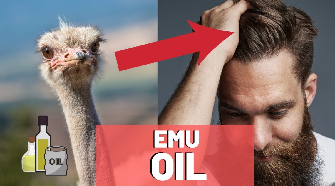 Do these weird hair loss fixes actually work? And what role does diet ...